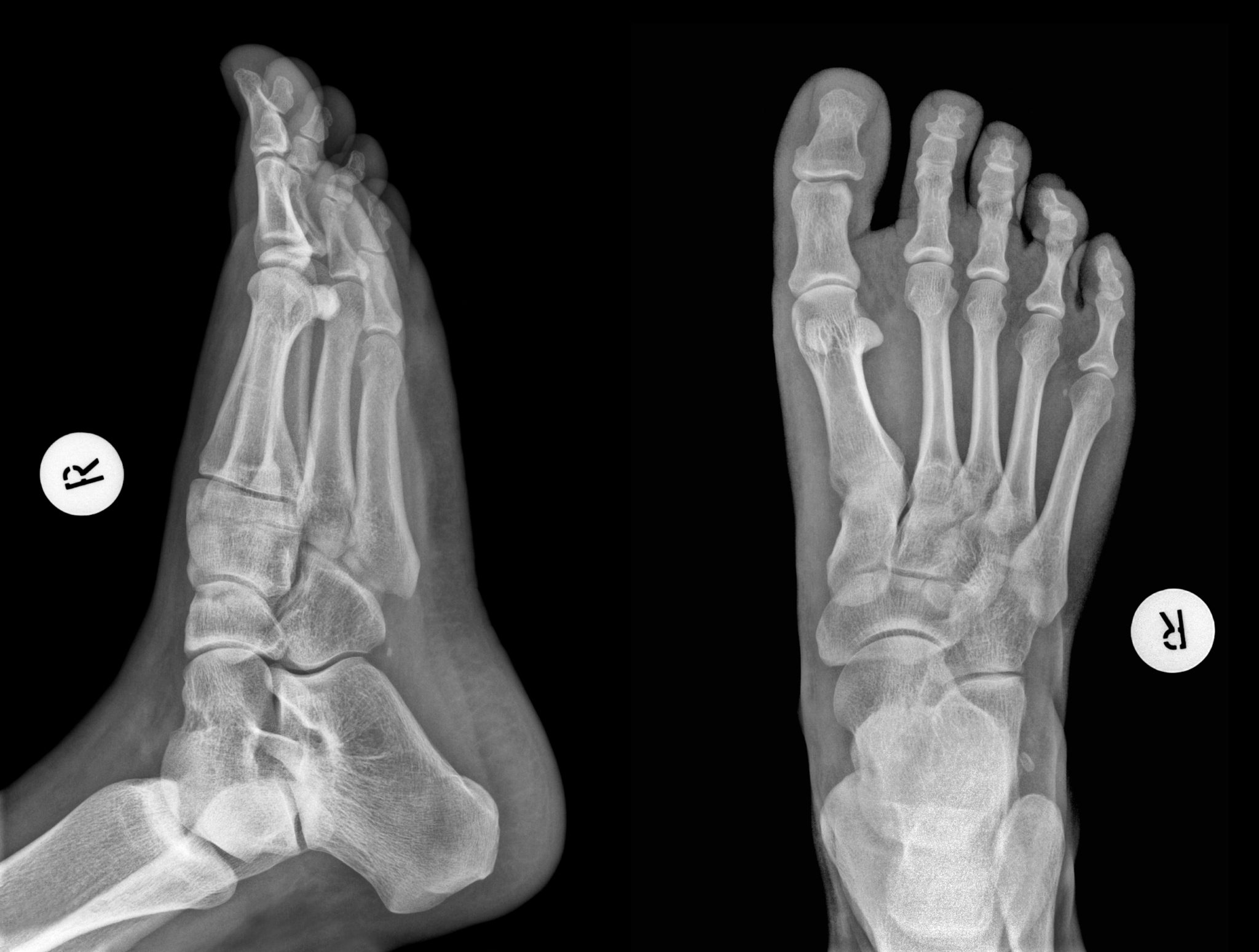 X-Ray and Ultrasound | Ames Foot & Ankle Specialists